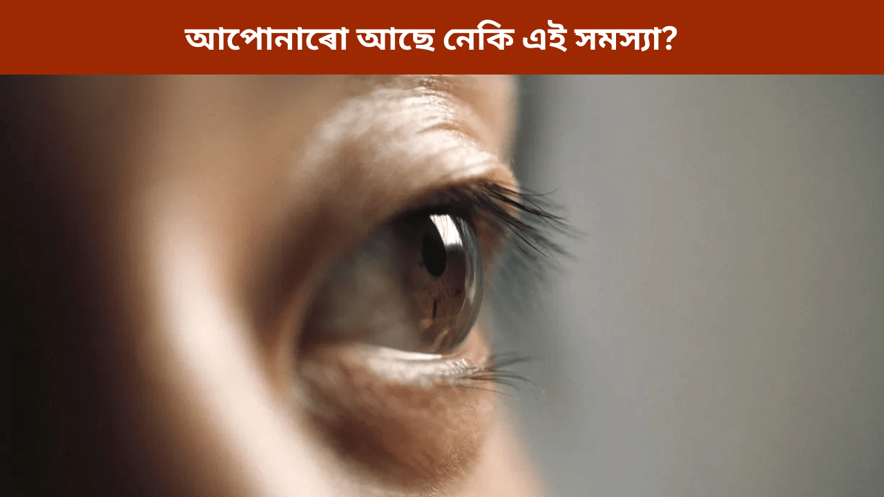 Watery Eyes: পুৱা শুই উঠাৰ পাছত চকুৰ পৰা পানী কিয় ওলায়? ই কি ৰোগৰ ...